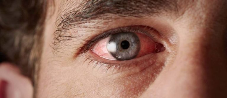 Signs of Being High on Drugs | Nova Recovery Center